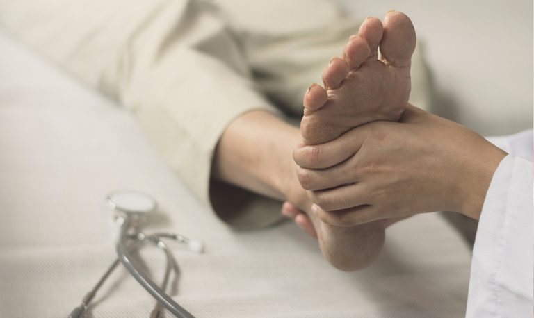 Pé chato (pé plano) – Clinica do Pé